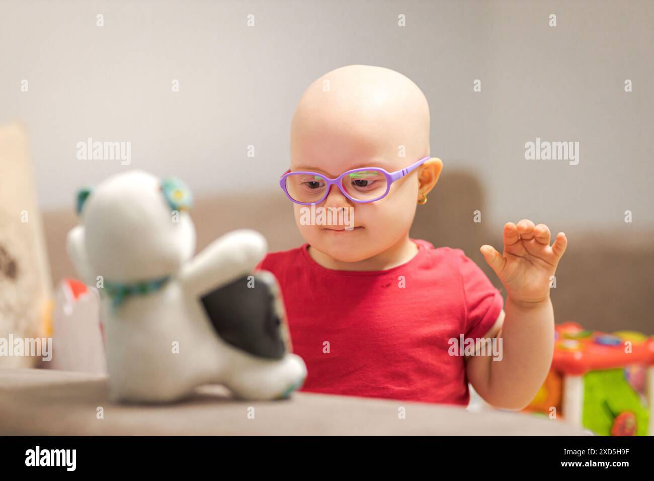 Little baby girl with cancer and hair loss due to chemotherapy ...