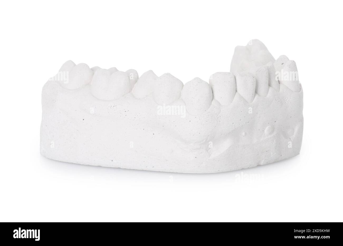 Dental model with gum isolated on white. Cast of teeth Stock Photo - Alamy