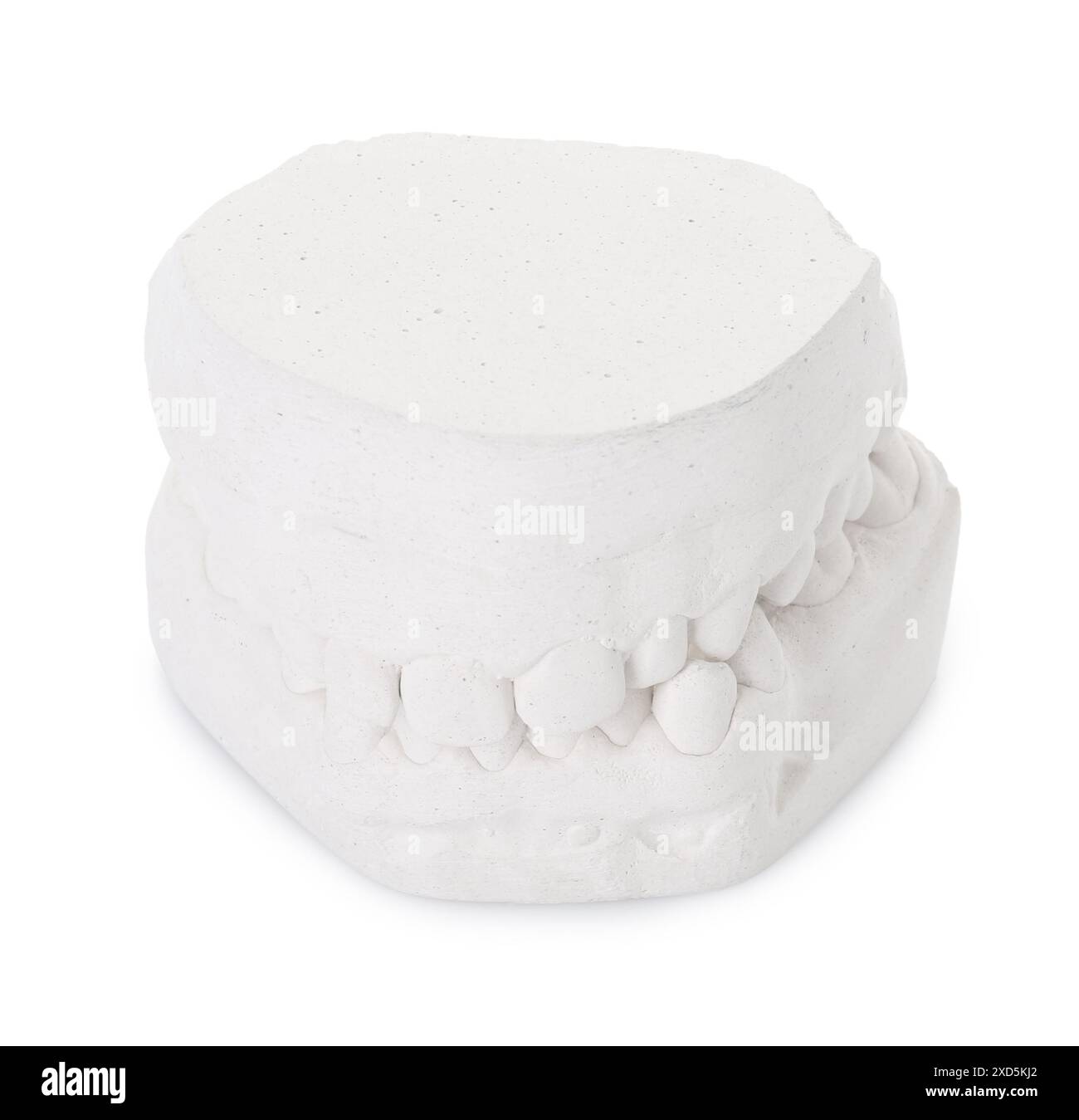 Dental model with gums isolated on white. Cast of teeth Stock Photo - Alamy