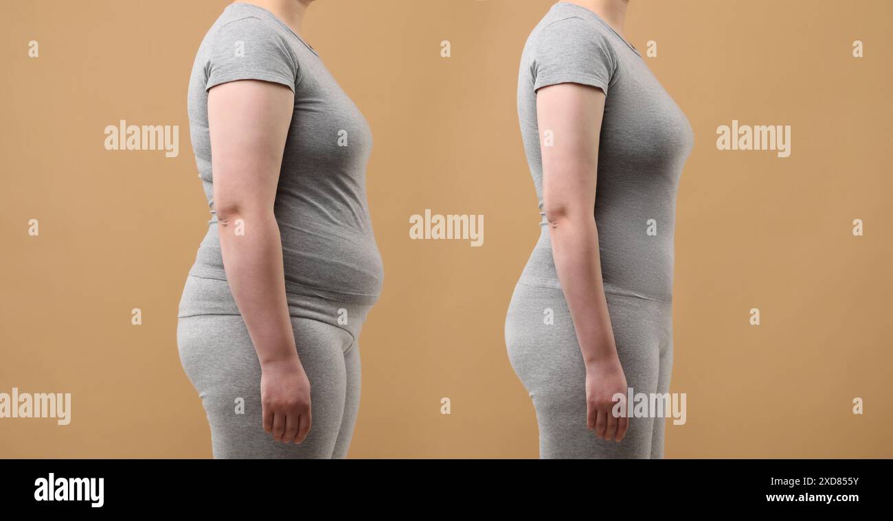 Collage with photos of woman before and after weight loss on beige ...