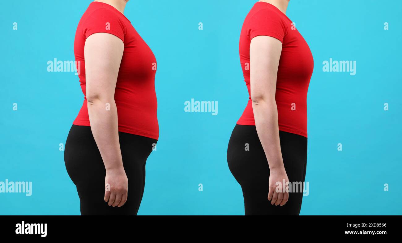 Collage with photos of woman before and after weight loss on light blue ...