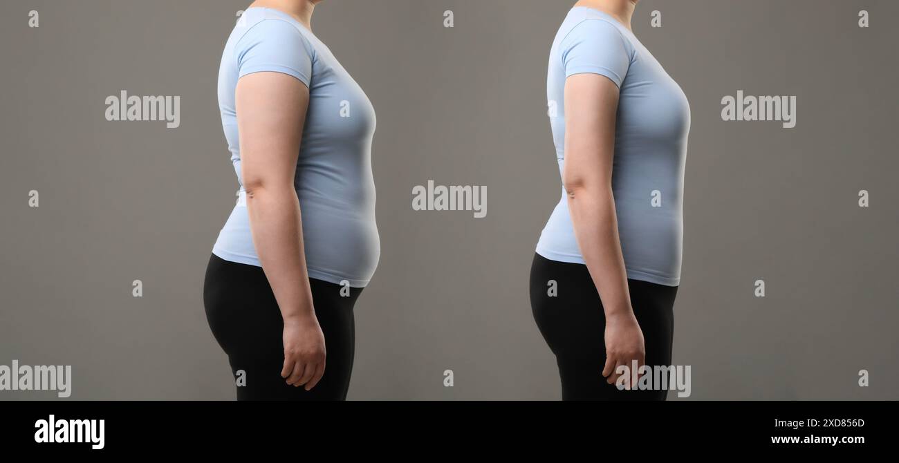 Collage with photos of woman before and after weight loss on grey ...