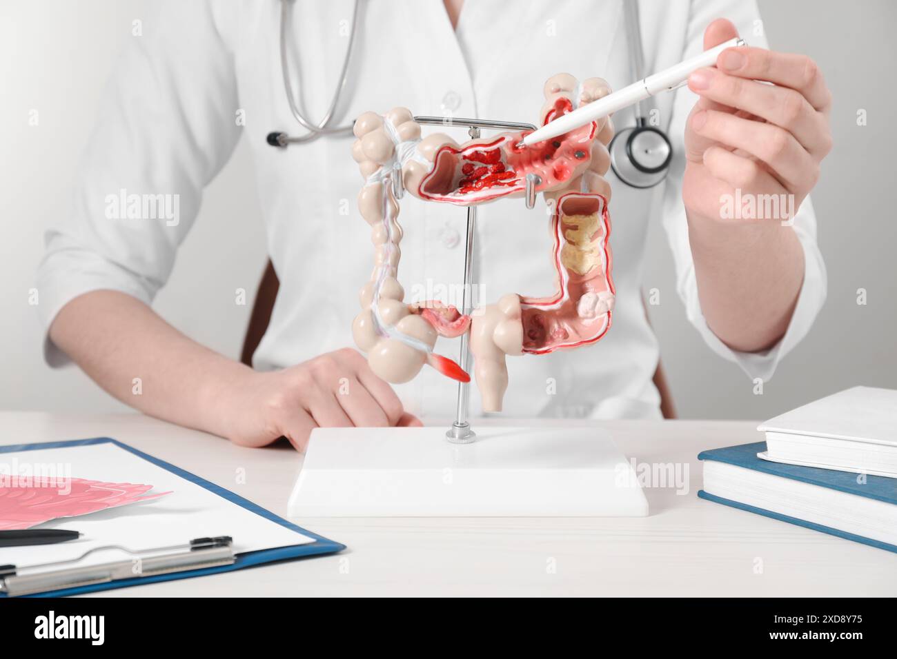 Doctor showing model of large intestine at table, closeup Stock Photo ...