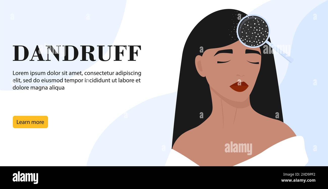 Women's dandruff problem on the head banner. Hair scalp problem. Fungal ...