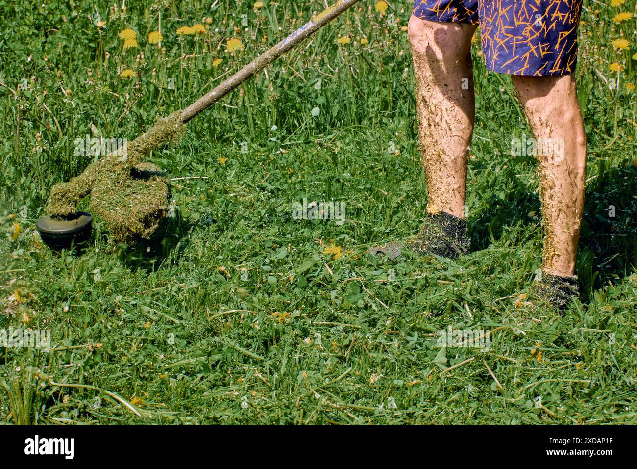 Unprotected feet when working with gas powered string trimmer are ...