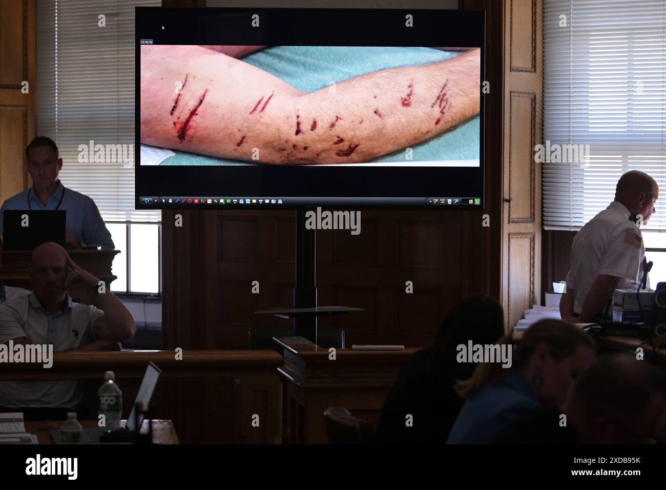 EDS NOTE: GRAPHIC CONTENT - An autopsy photo showing injuries to John O ...