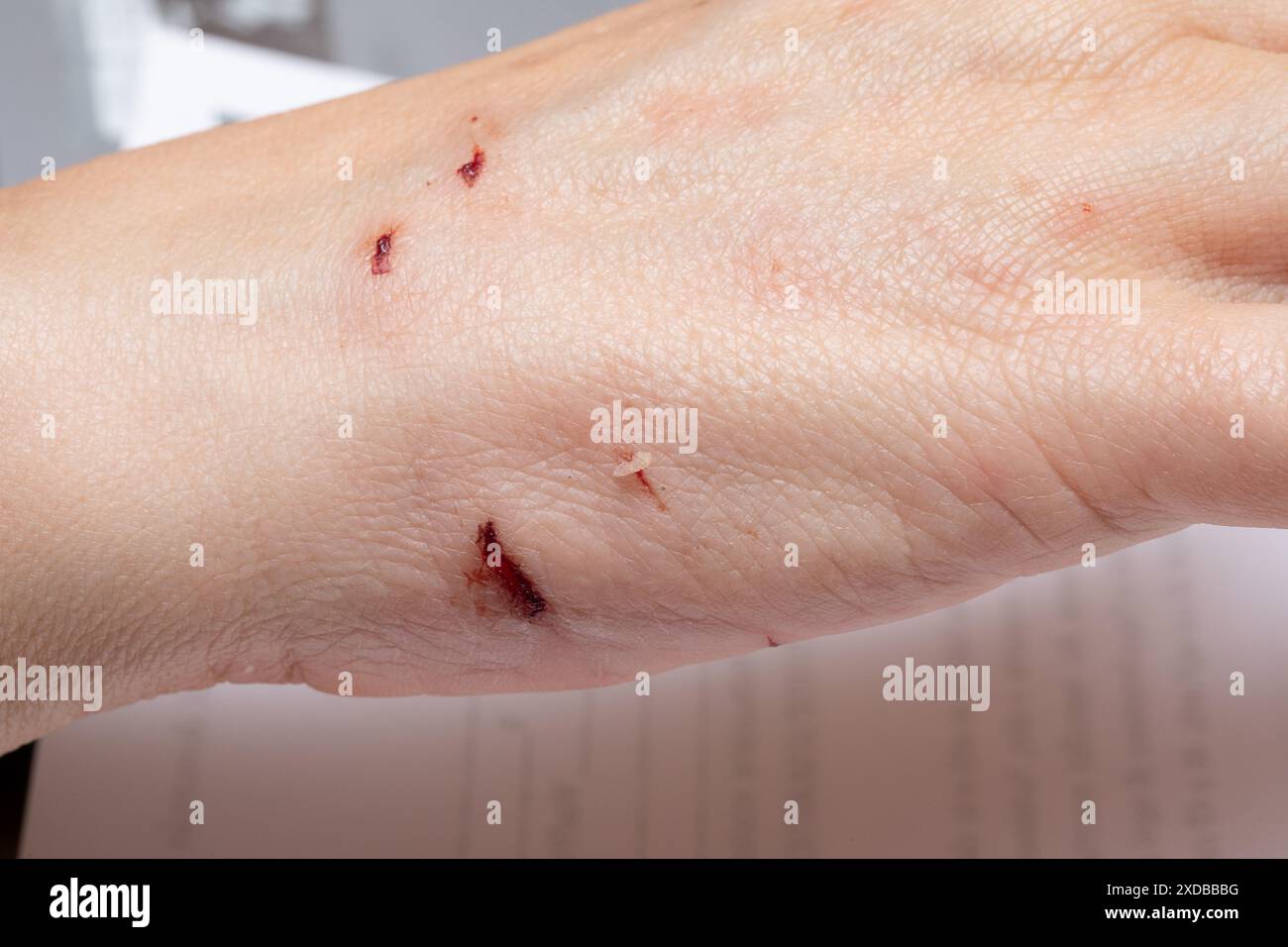 Macro of the scratches and bites of a cat in the owner's hand. Closeup ...