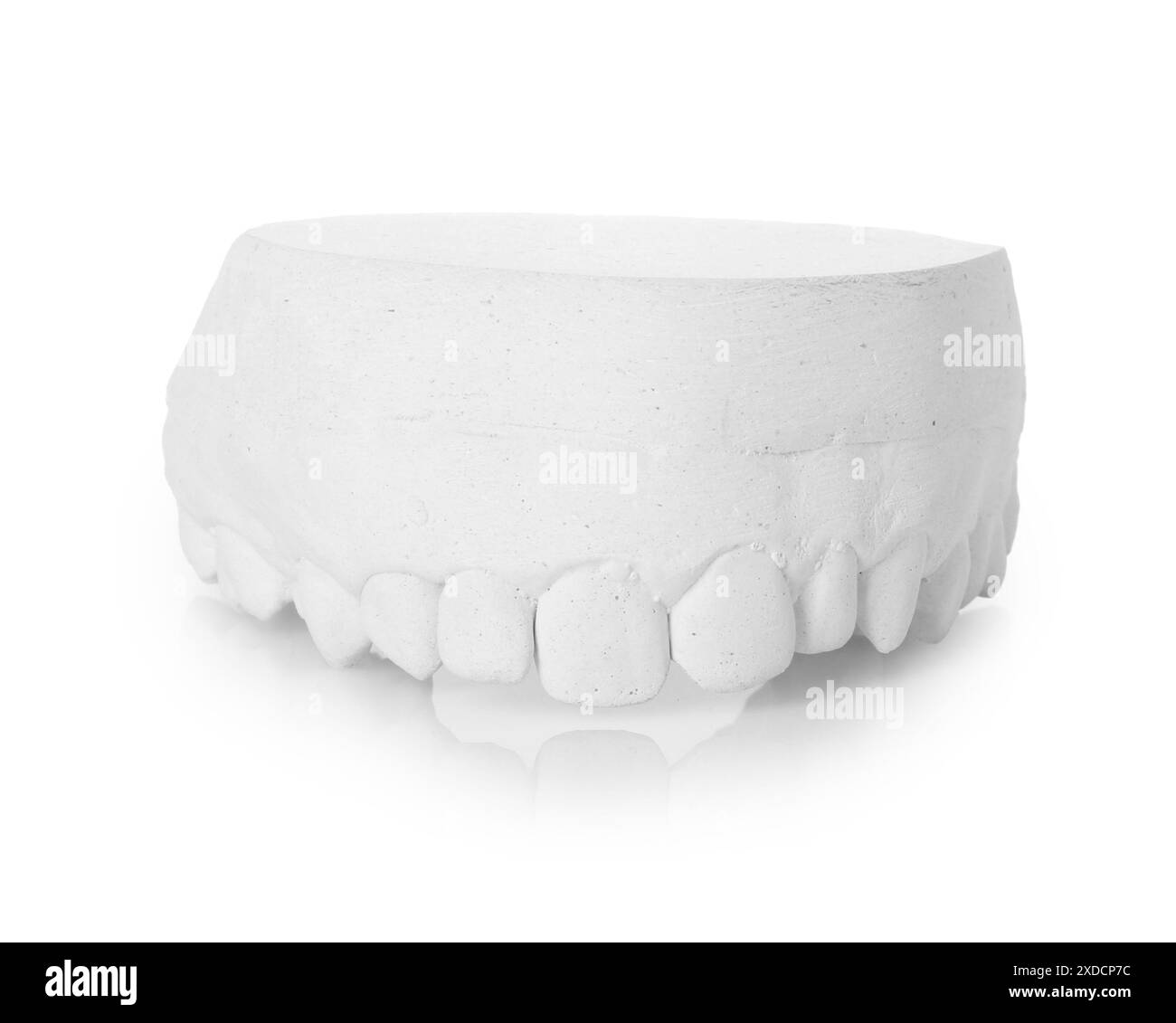 Dental model with gum isolated on white. Cast of teeth Stock Photo - Alamy