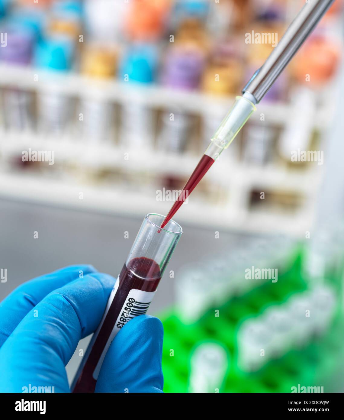 Scientist research blood cancer hi-res stock photography and images - Alamy