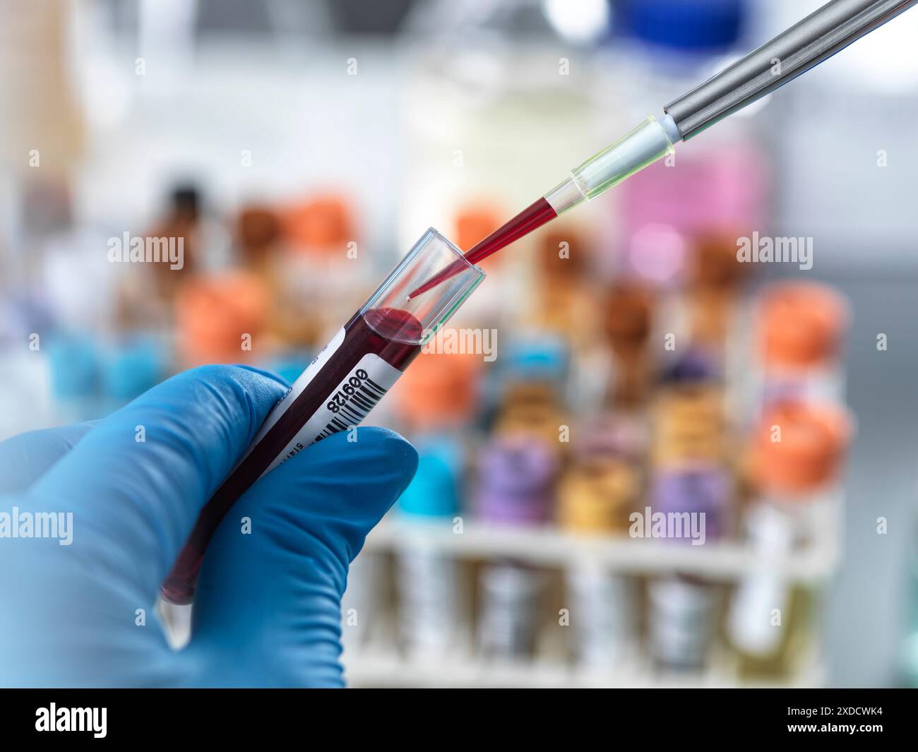 Scientist research blood cancer hi-res stock photography and images - Alamy
