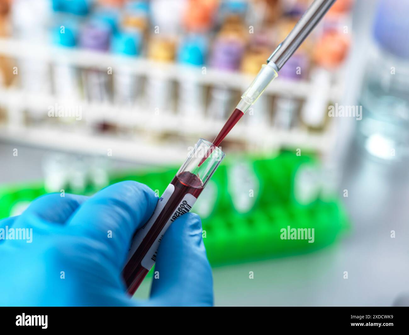 Scientist research blood cancer hi-res stock photography and images - Alamy