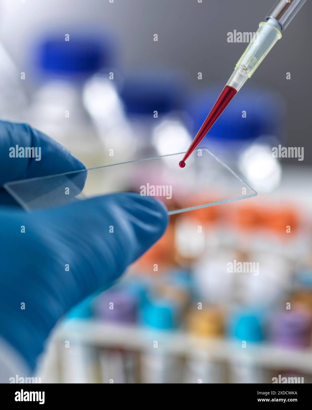 Scientist placing a human blood sample onto a microscope slide for ...