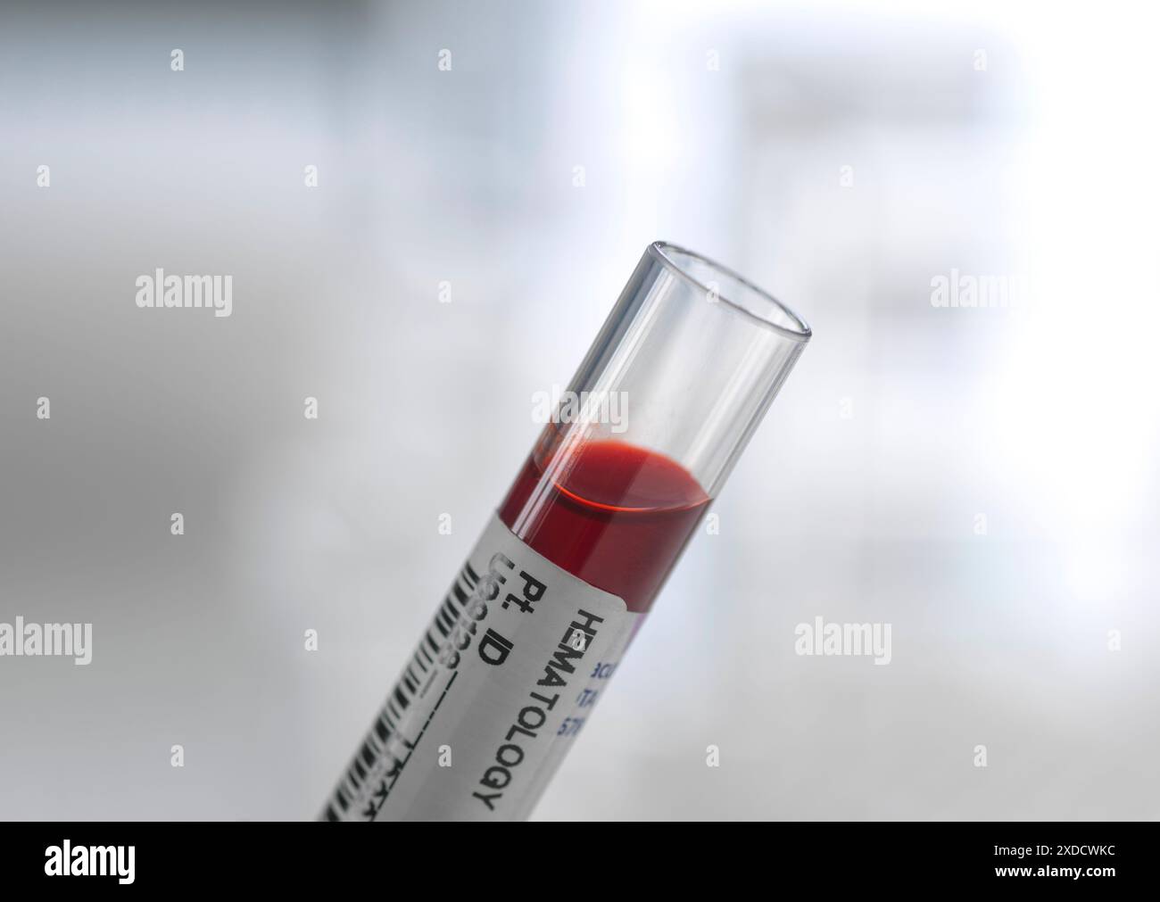 Analytical tests hi-res stock photography and images - Alamy