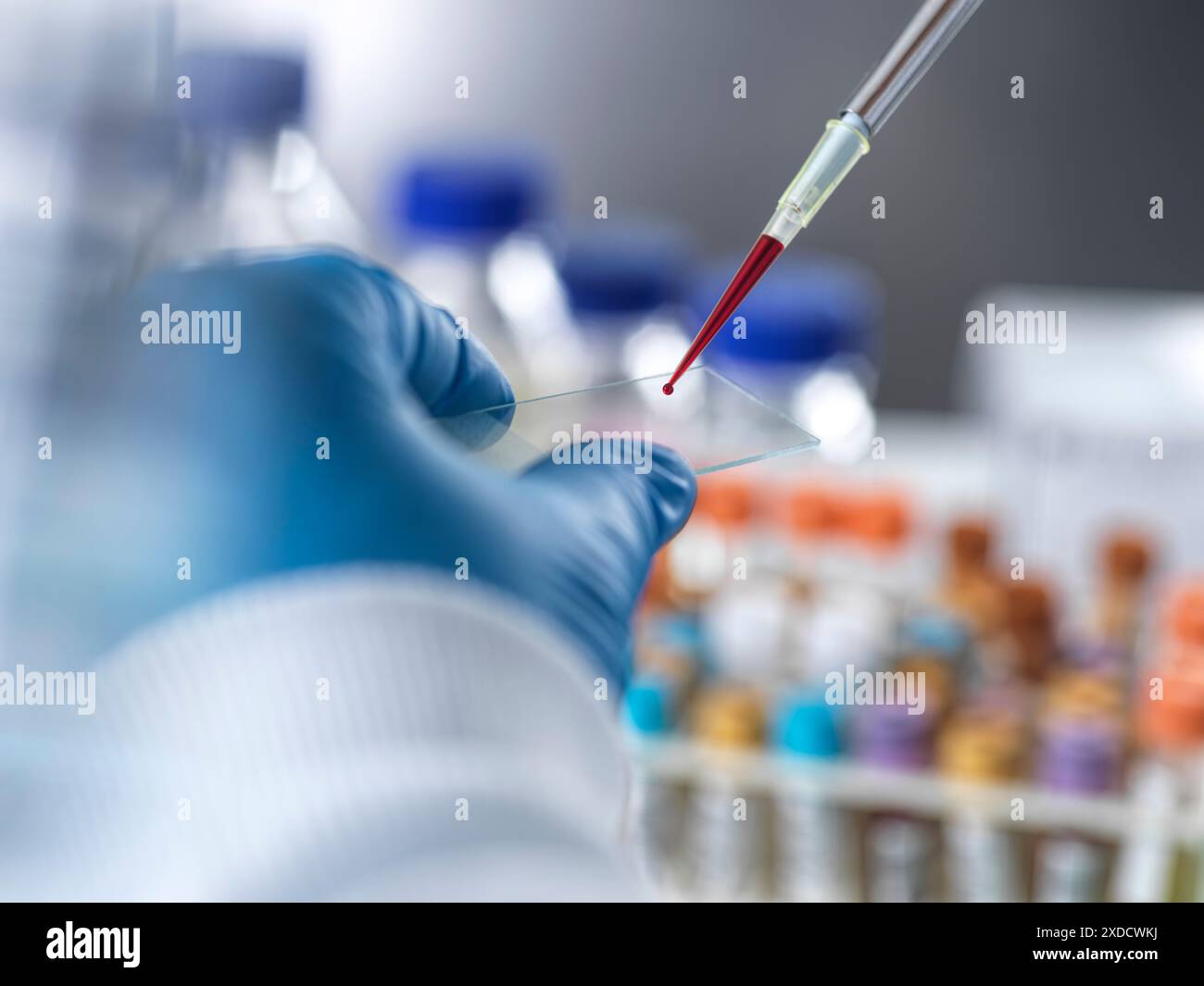 Scientist placing a human blood sample onto a microscope slide for ...