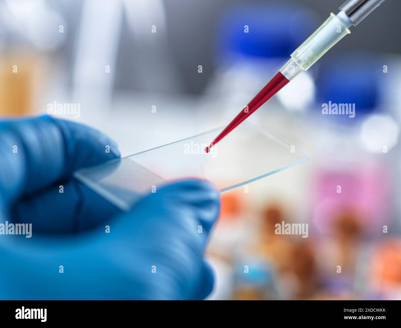 Scientist placing a human blood sample onto a microscope slide for ...