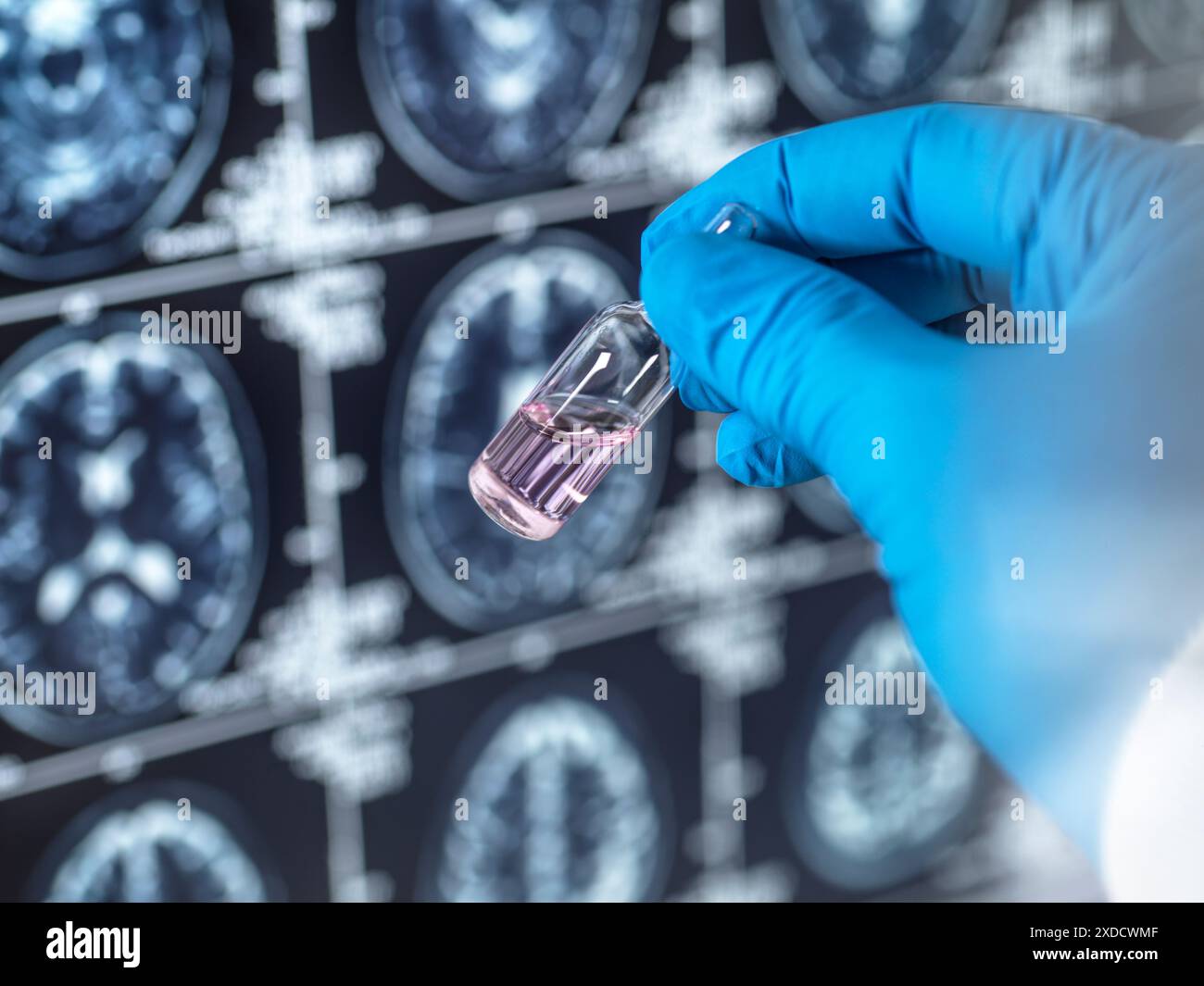 Scientist holding up a potential cure for dementia and Alzheimer's ...