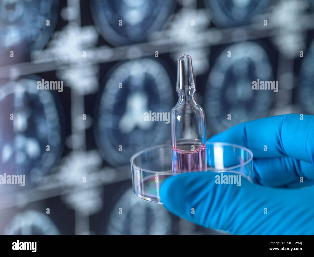 Scientist holding up a potential cure for dementia and Alzheimer's ...
