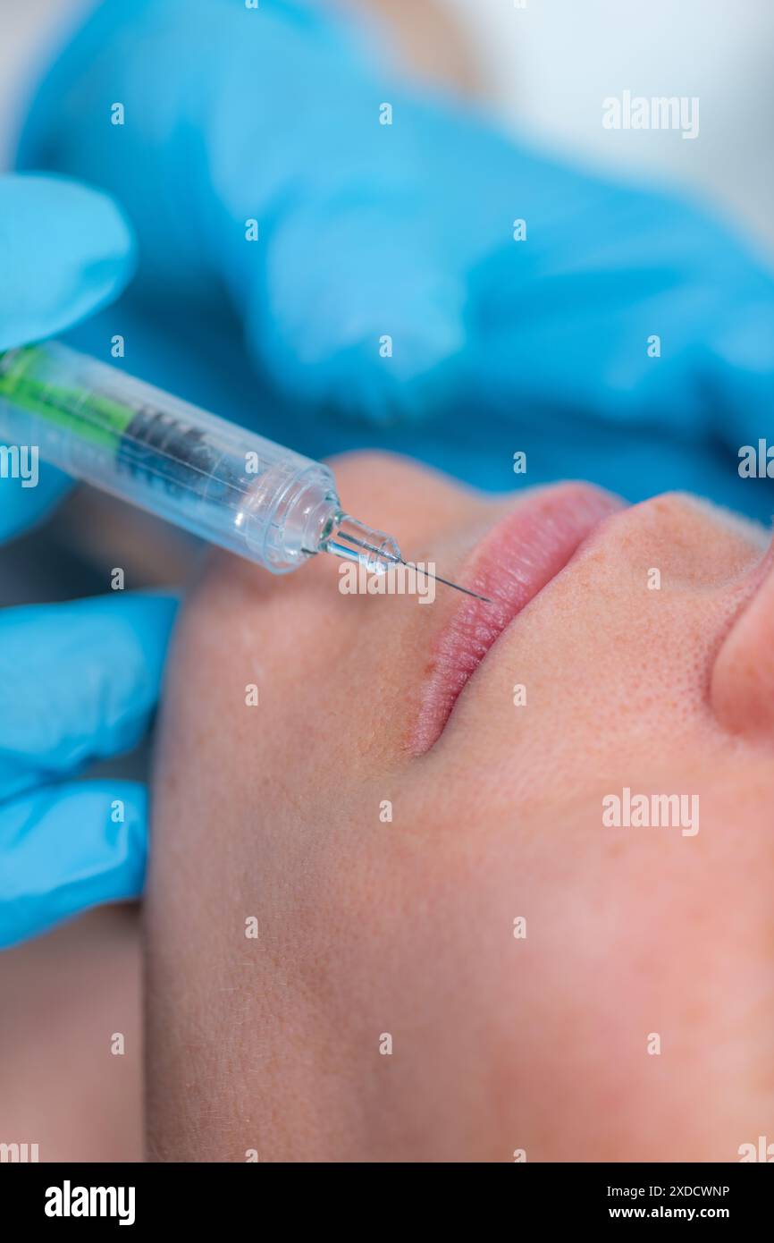 Hyaluronic acid lip fillers hi-res stock photography and images - Alamy