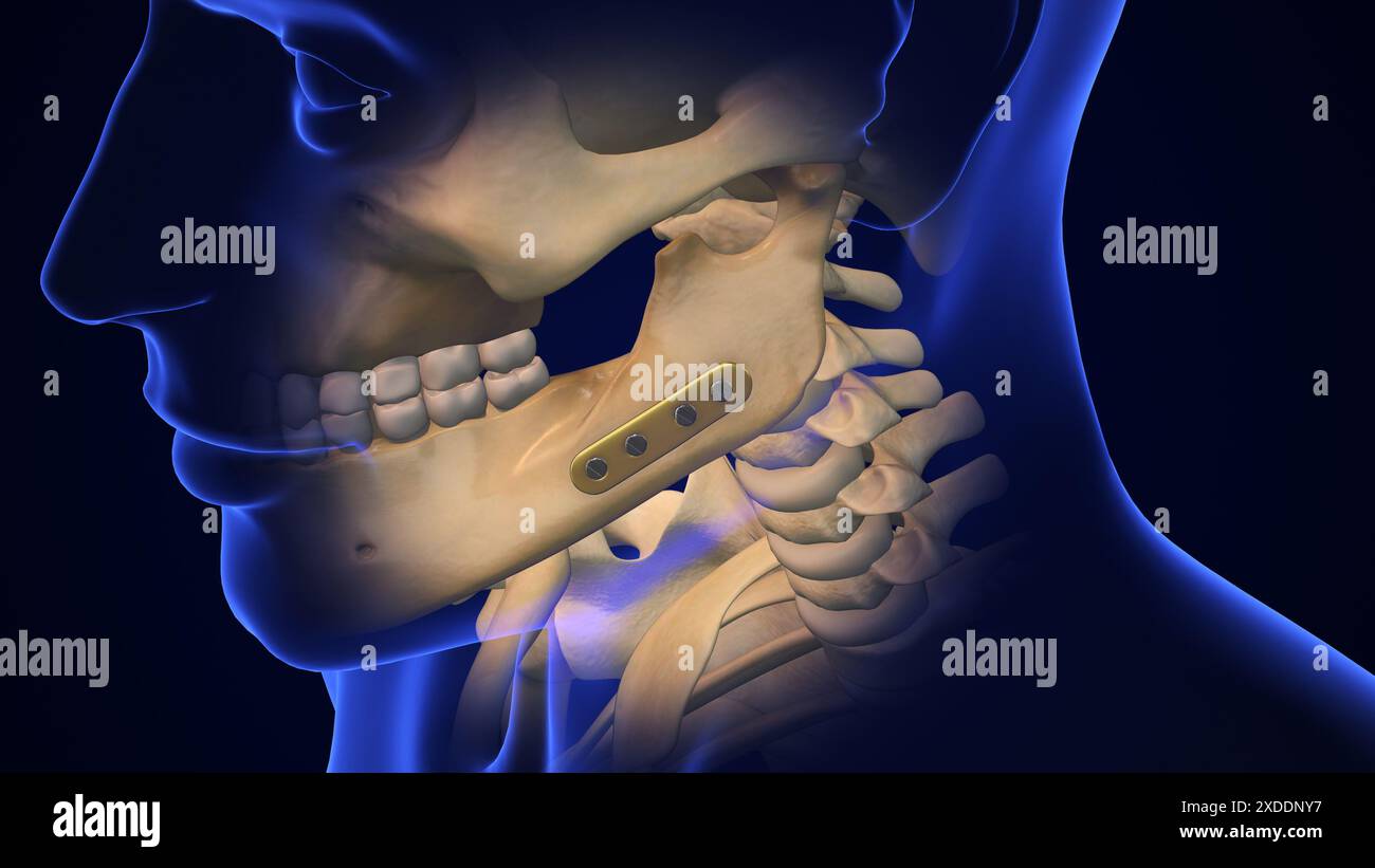 Broken jaw hi-res stock photography and images - Alamy