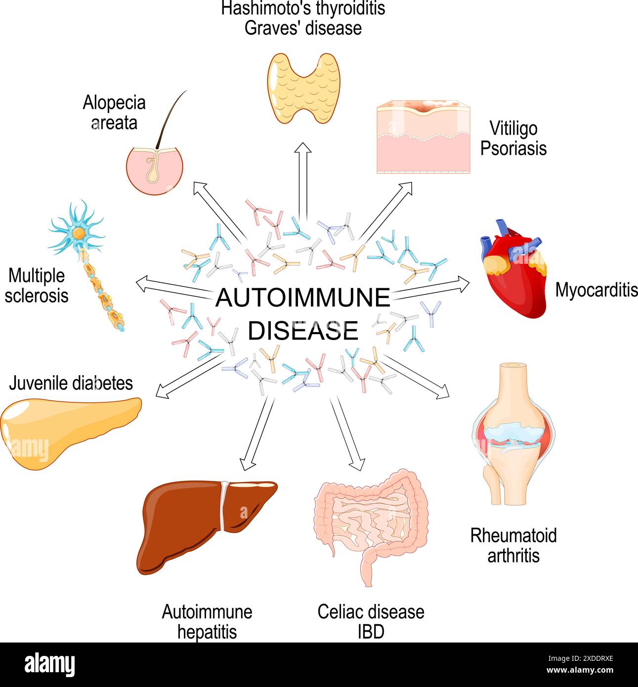 Liver disease skin hi-res stock photography and images - Alamy