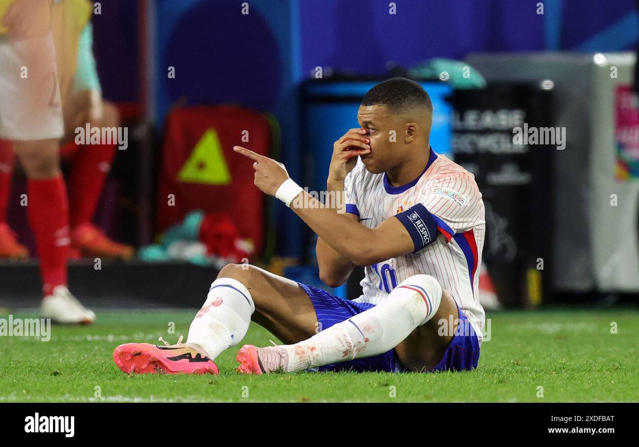 Kylian Mbappe of France with broken nose UEFA EURO 2024 group stage ...
