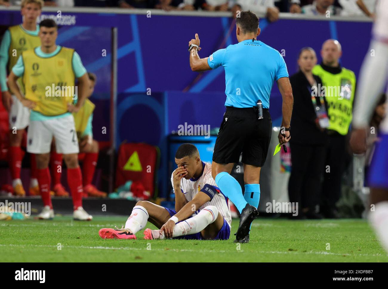 Kylian Mbappe of France with broken nose UEFA EURO 2024 group stage ...