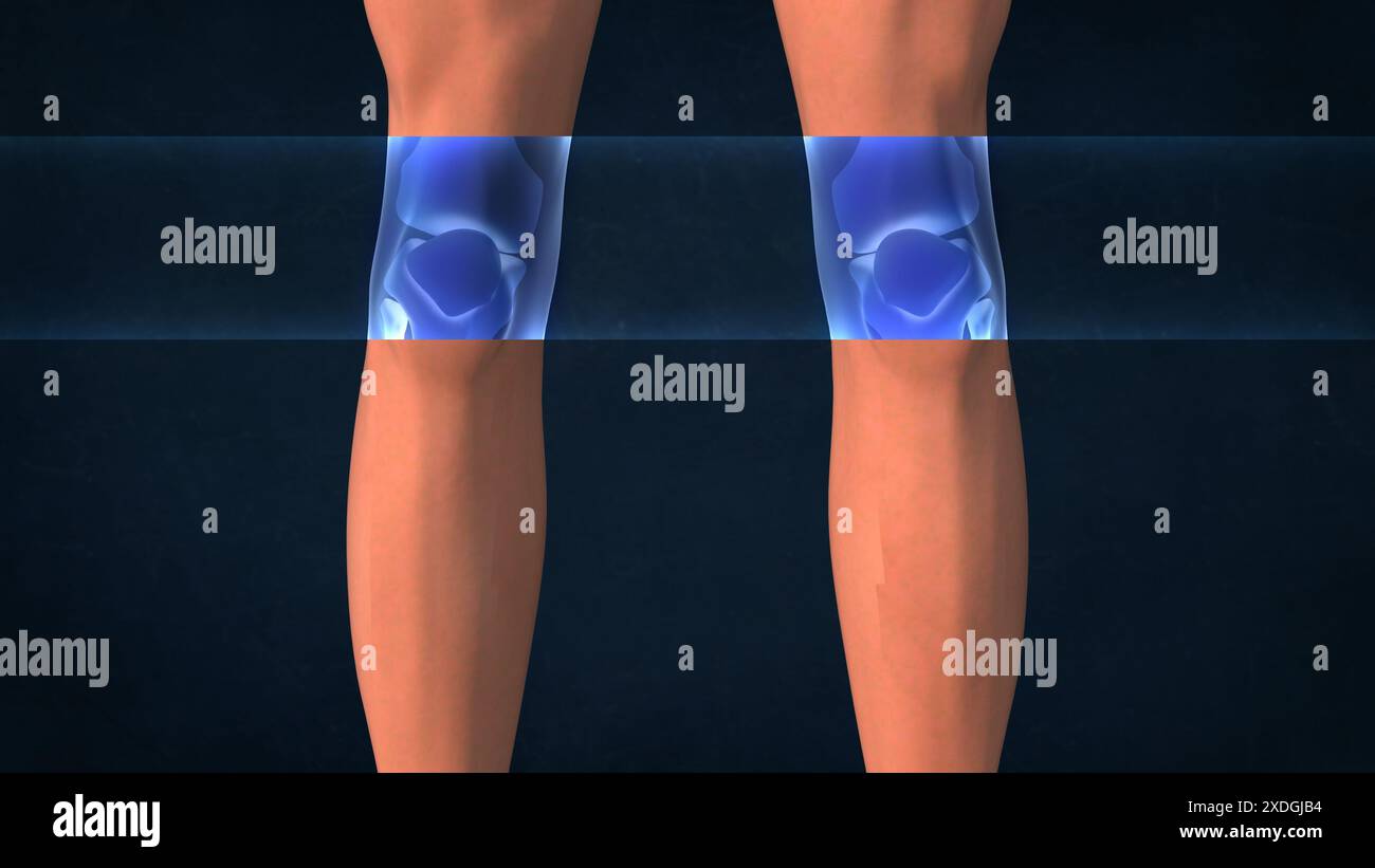 Human knee joint meniscus hi-res stock photography and images - Alamy