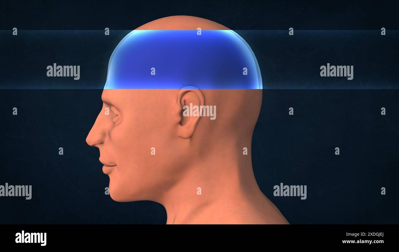 Head trauma skull fracture hi-res stock photography and images - Alamy