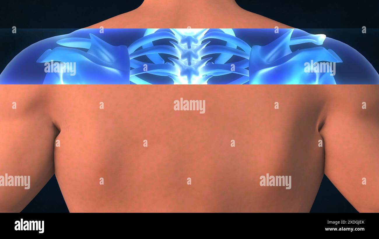 An X-ray of a human lower back Stock Photo - Alamy
