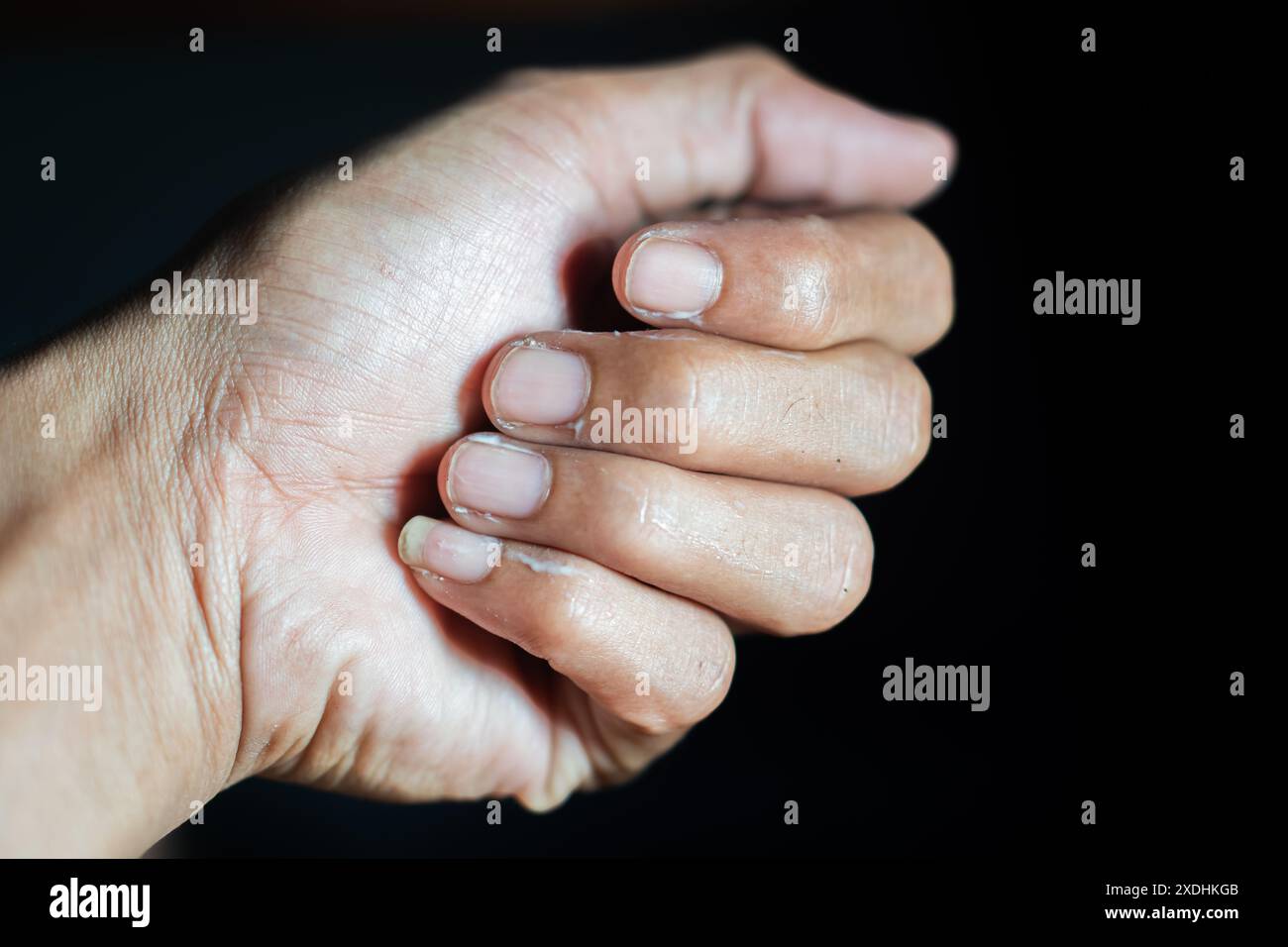 Close-up of a clenched human hand with visible skin texture and ...