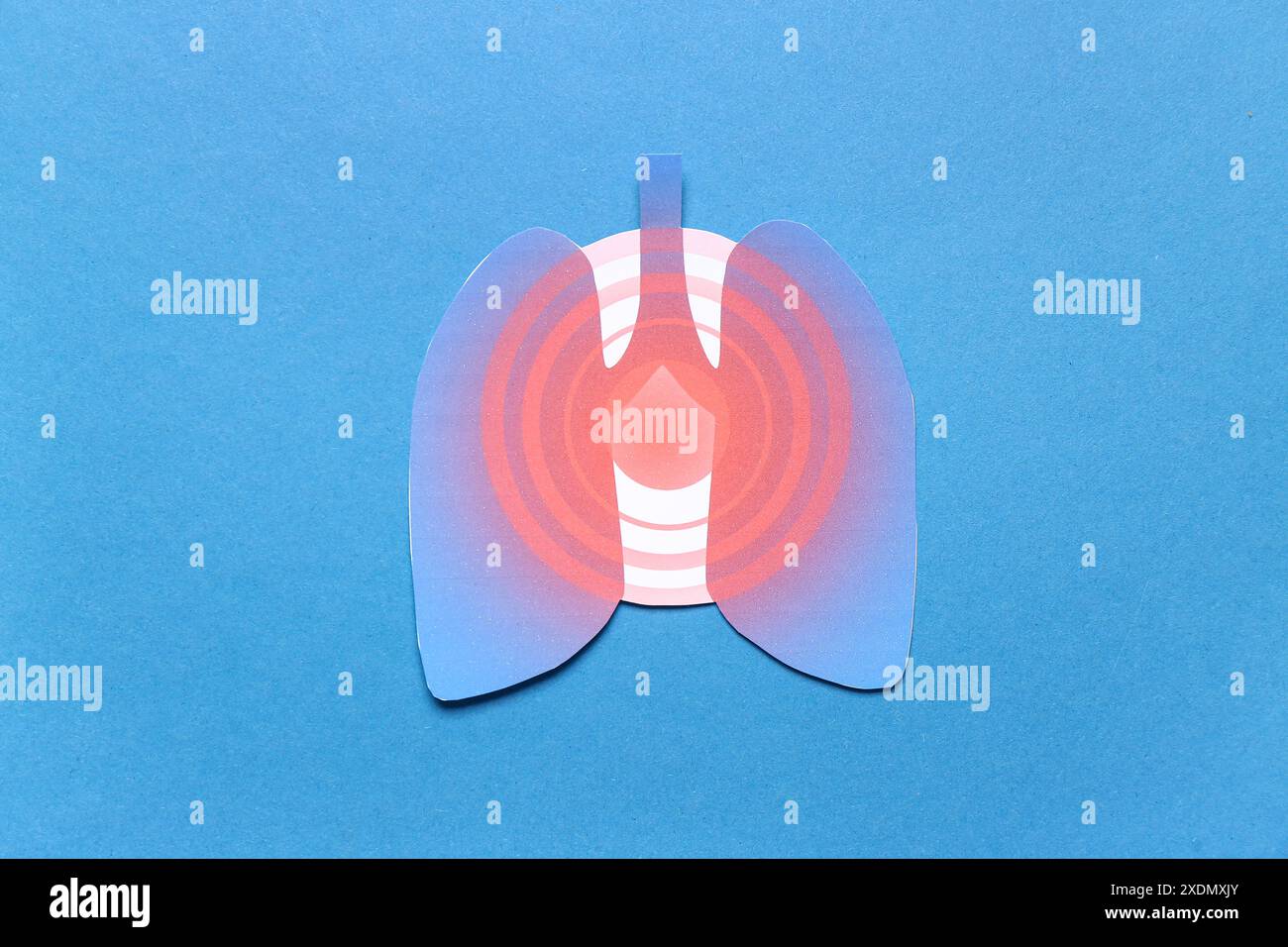 Sick unhealthy lungs tuberculosis hi-res stock photography and images ...