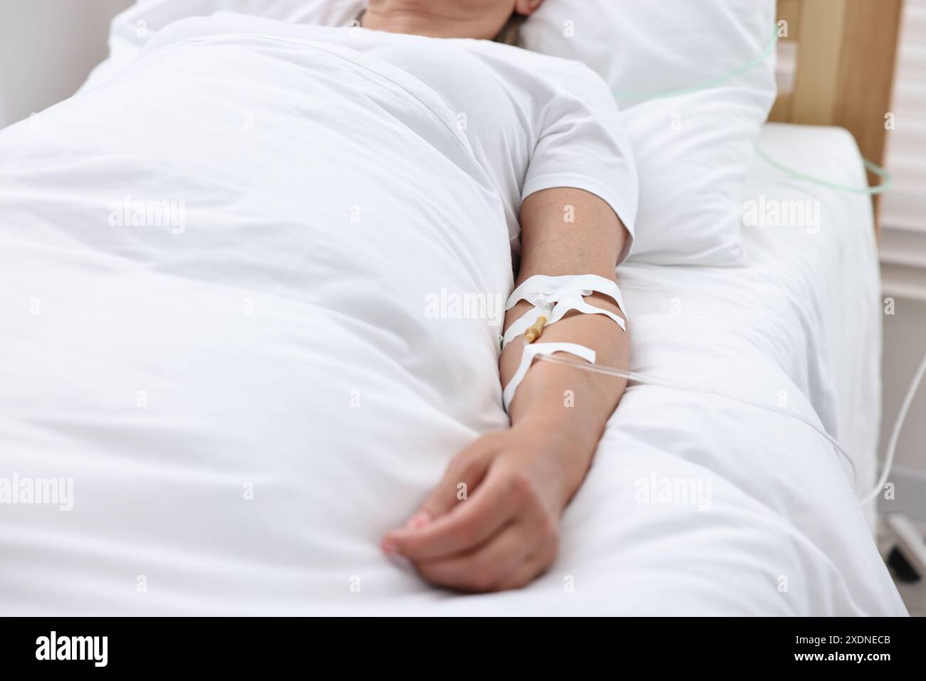 Coma patient. Woman with intravenous drip in hospital bed, closeup ...