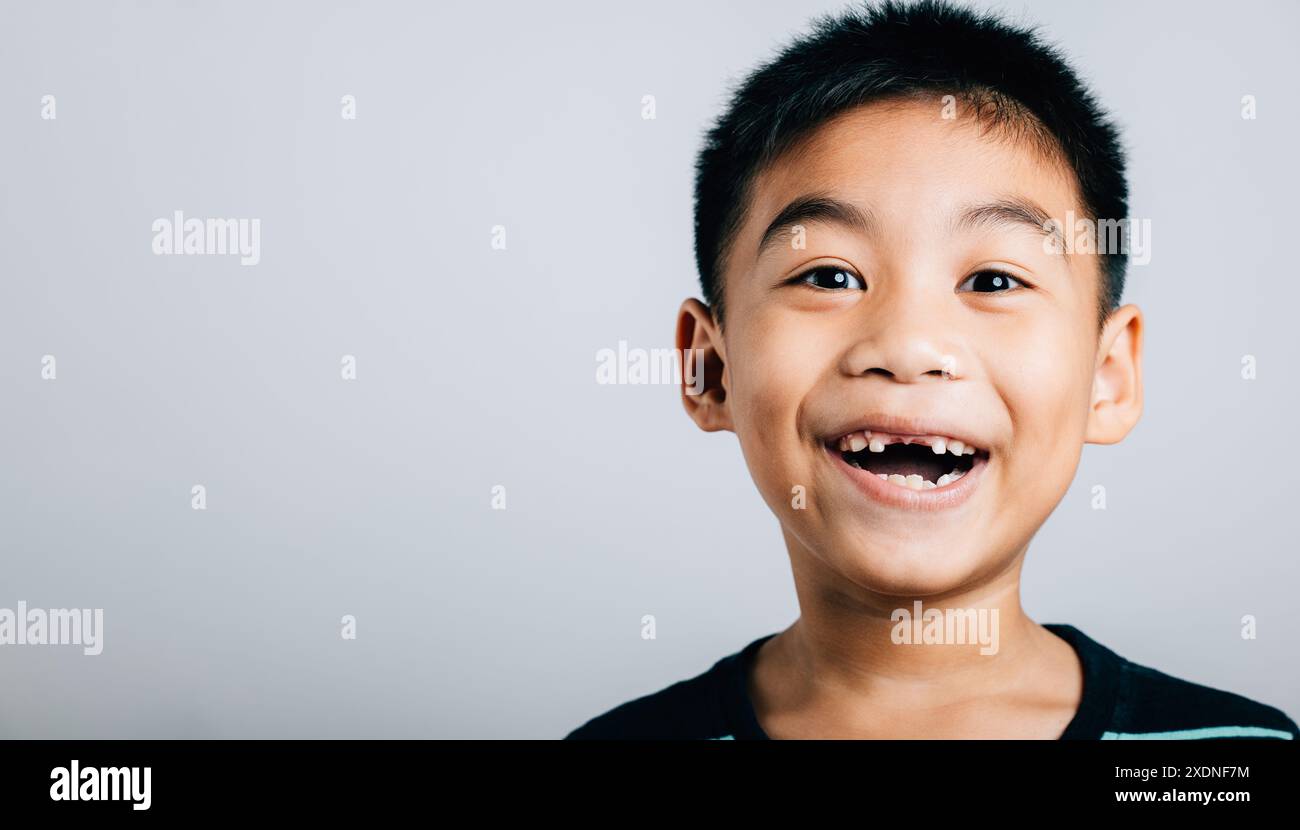 Child with missing upper tooth wide smile showing gap. Dental growth ...