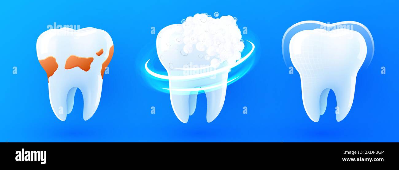 3d realistic vector healthy glowing tooth. Dental plaque healing and ...