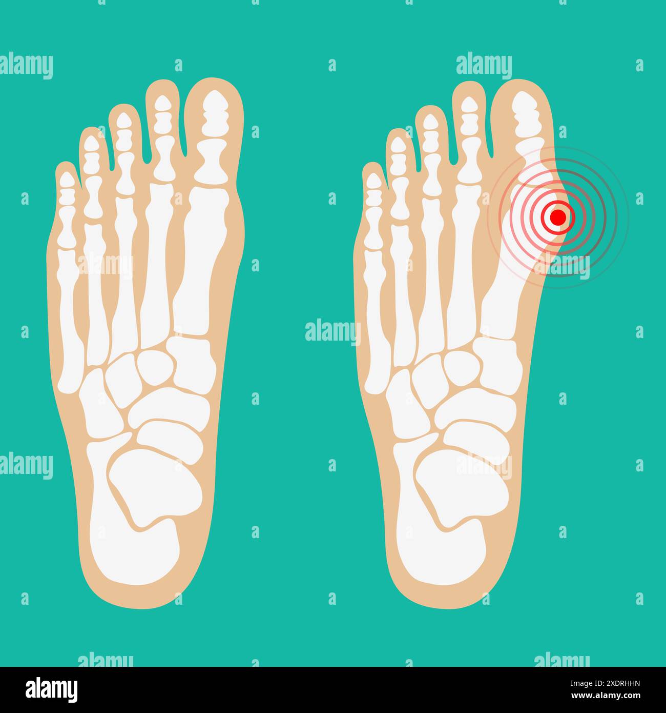 Angle joint Stock Vector Images - Alamy