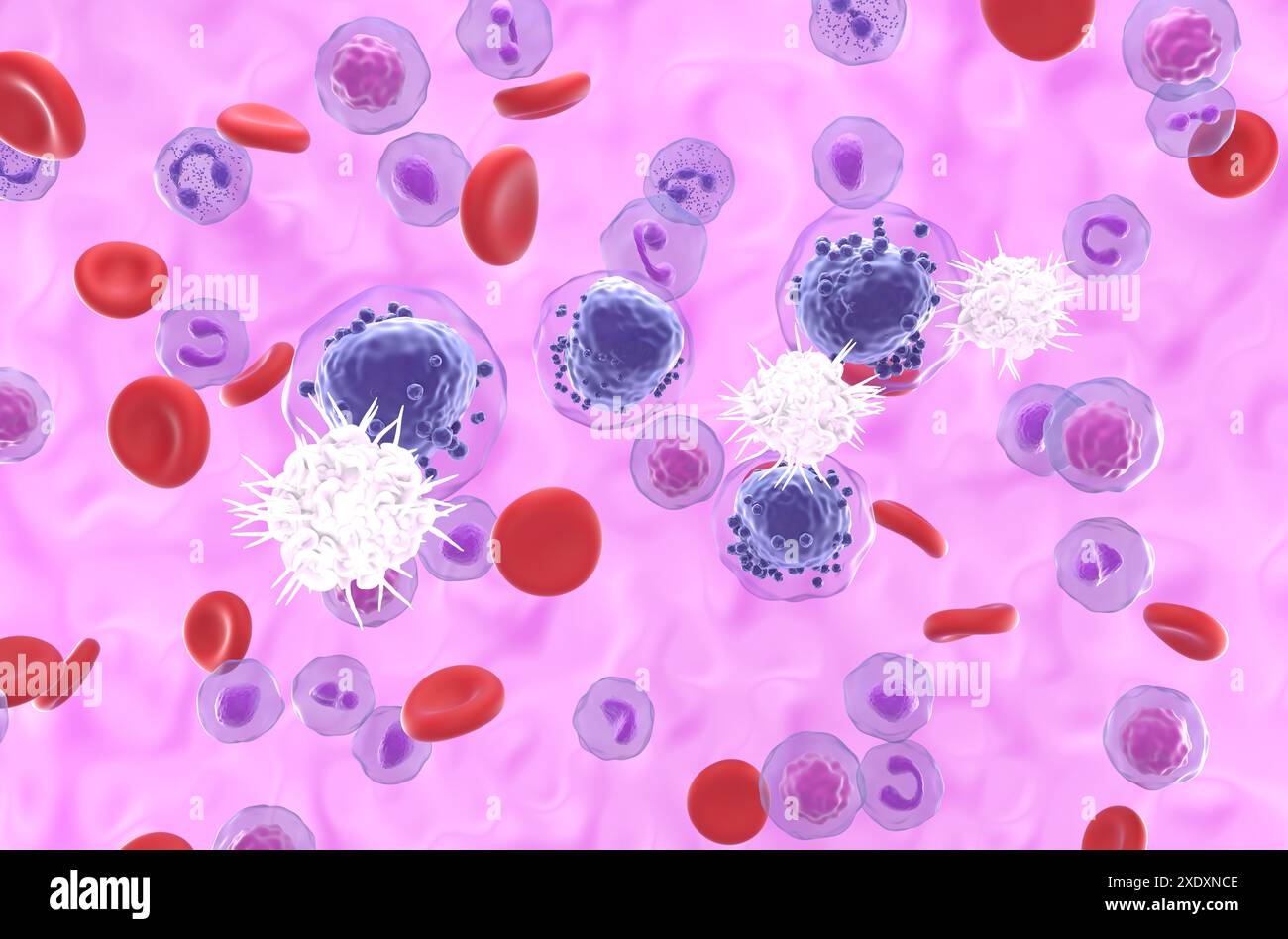 Dendritic cells (DC) recognize Acute myeloid leukemia (AML) - isometric ...