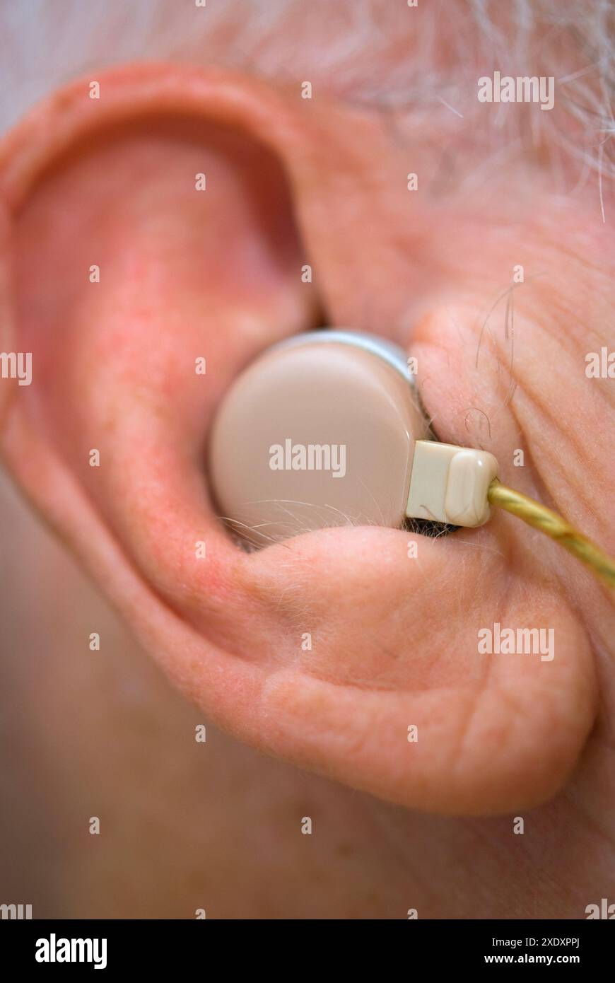 Ear disease symbol hi-res stock photography and images - Alamy
