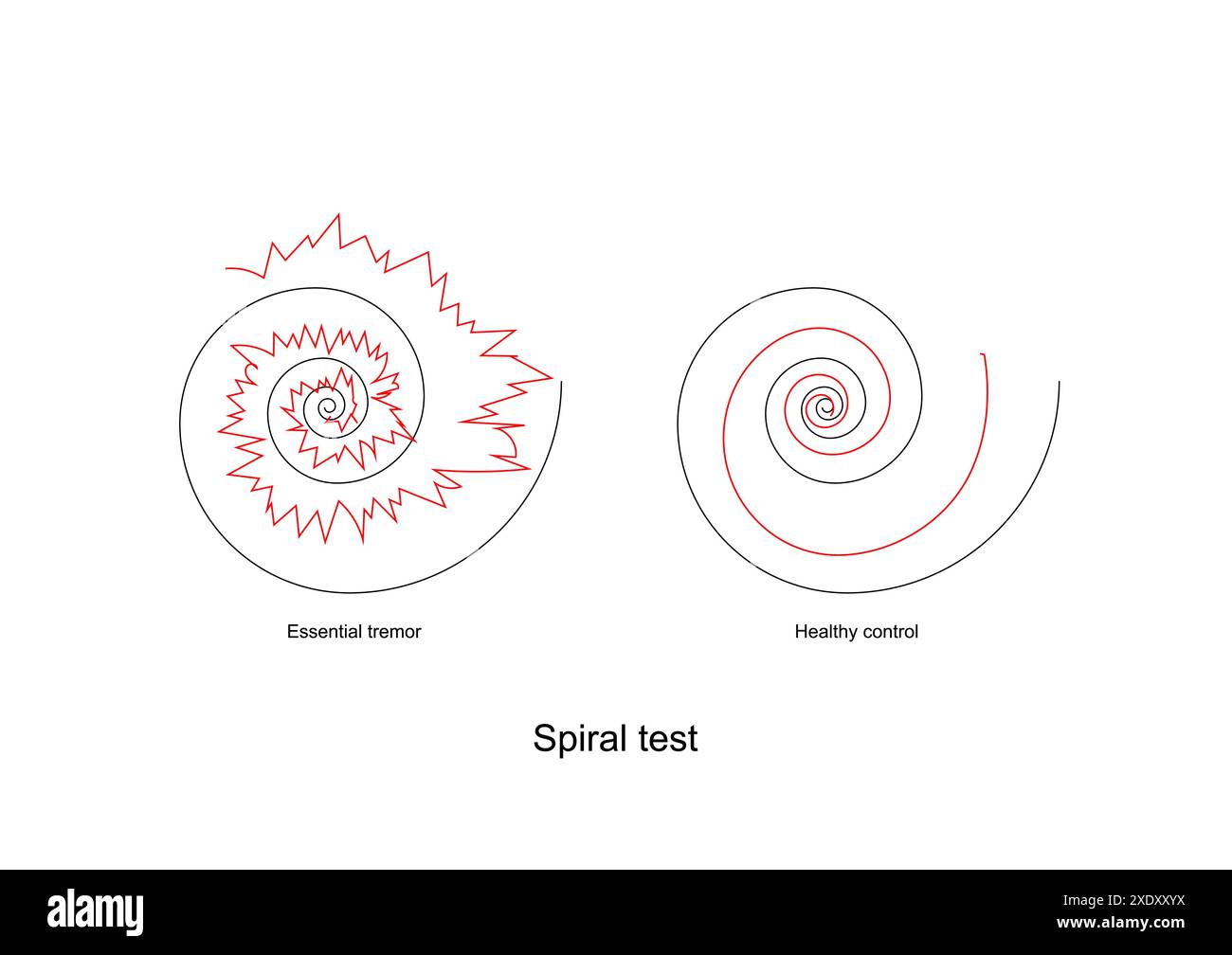 Comparison of spiral drawings showcasing the differences between ...