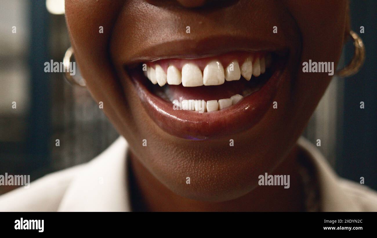 Bright teeth lips in hi-res stock photography and images - Alamy