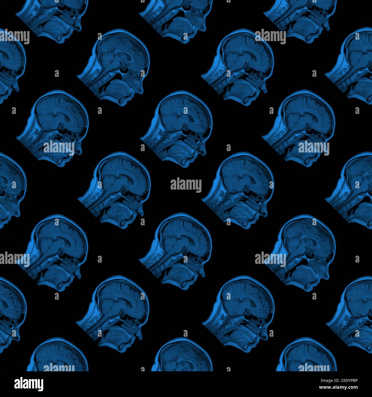 Seamless pattern of MRI scans of sixty years old caucasian female head ...