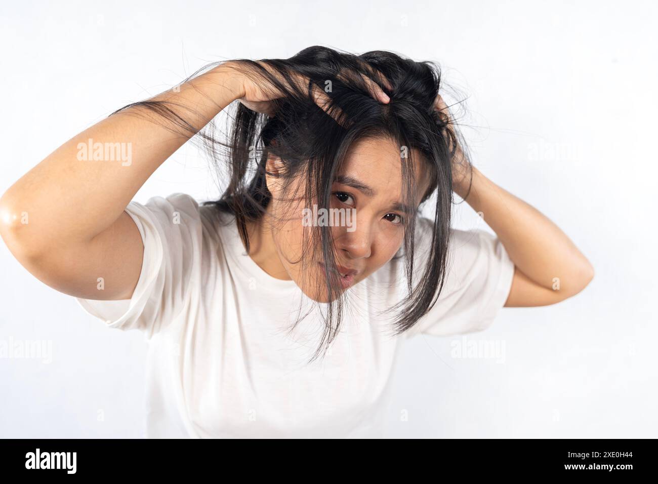 Itching Dry Head Scalp And Long Hair With Dandruff. A woman with long ...