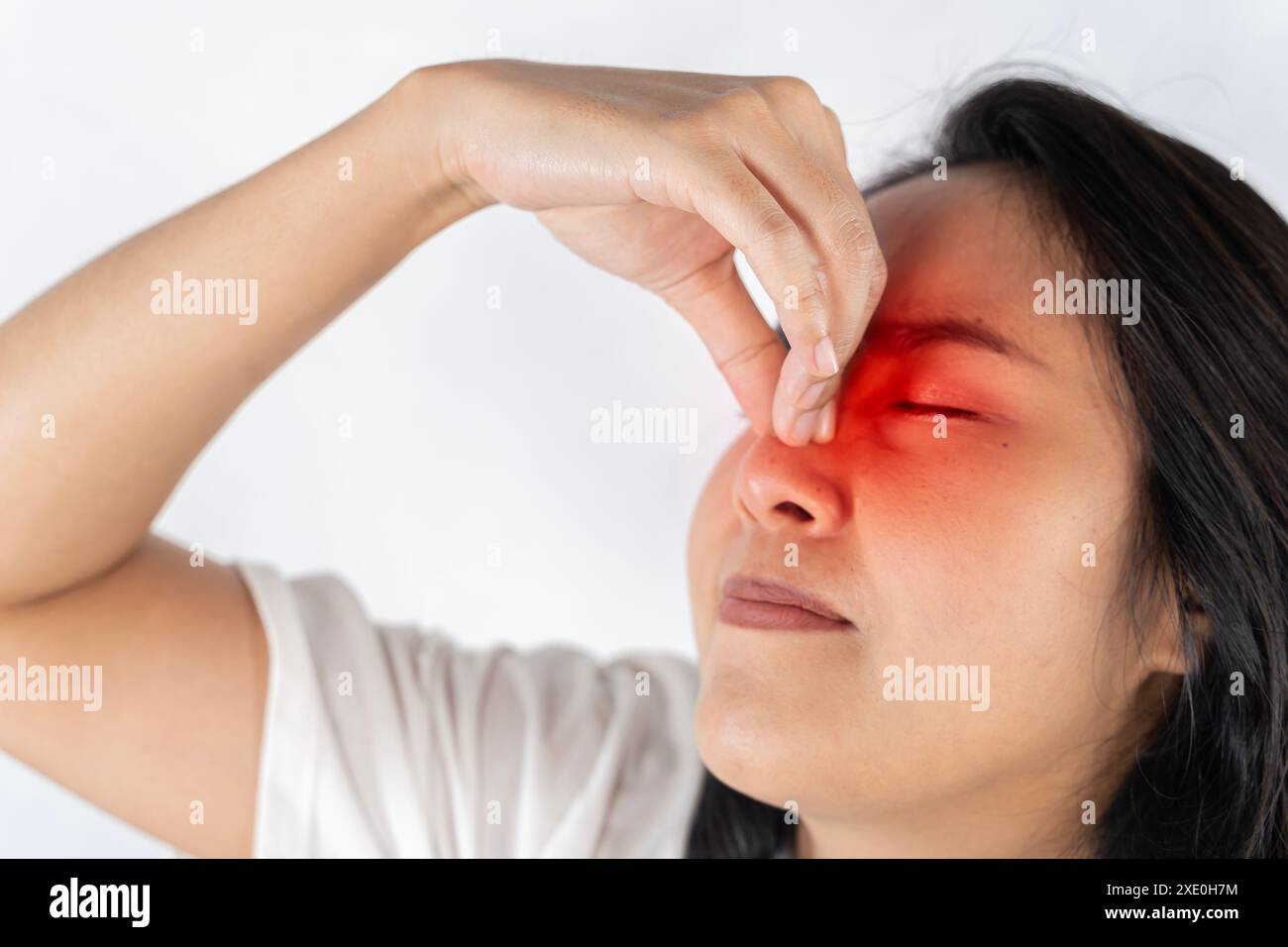 Sick woman suffers from flu, cold, running nose, asian caucasian indoor ...