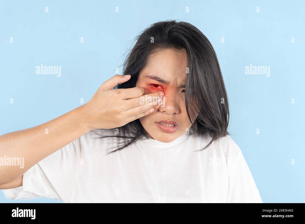 Young girl suffering from eyes pain and feeling something in eye ...