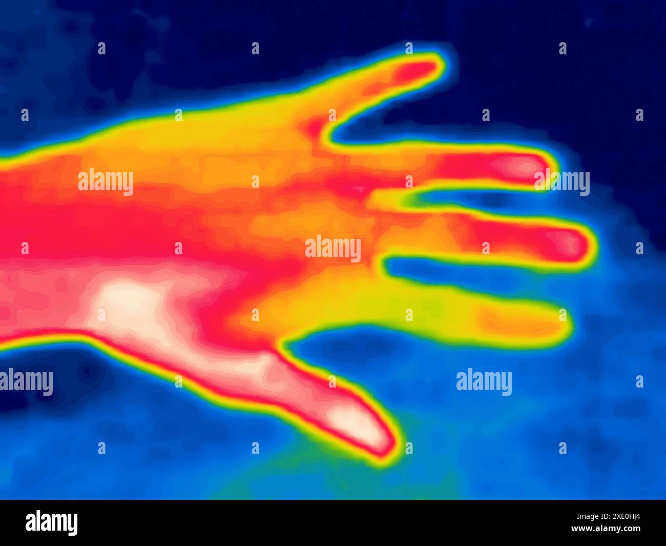 Thermography arm hi-res stock photography and images - Alamy