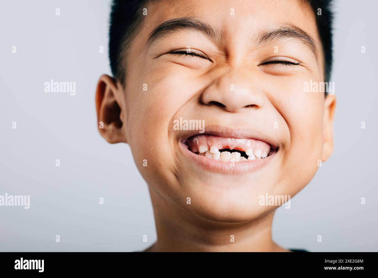 Cheerful kid lost upper tooth gap in smile. Child dental development ...
