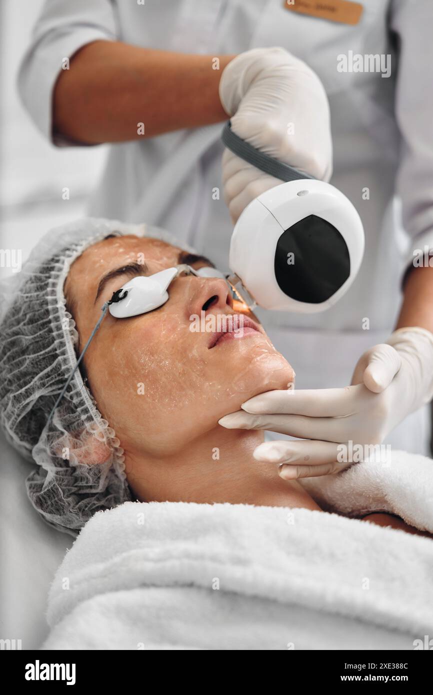 Woman receives ipl therapy hi-res stock photography and images - Alamy