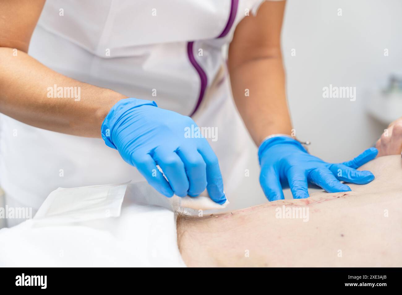 Hand of Doctor is using clean cotton dressing infection wound at a man ...