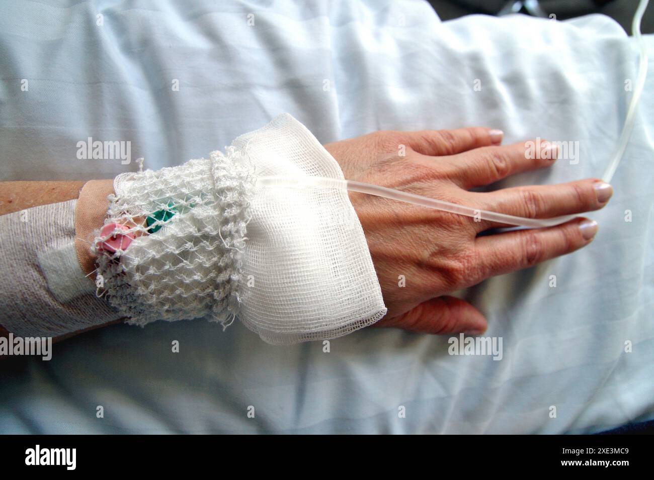 Female patient with infusion drip in hospital. arm of Woman, patient's ...