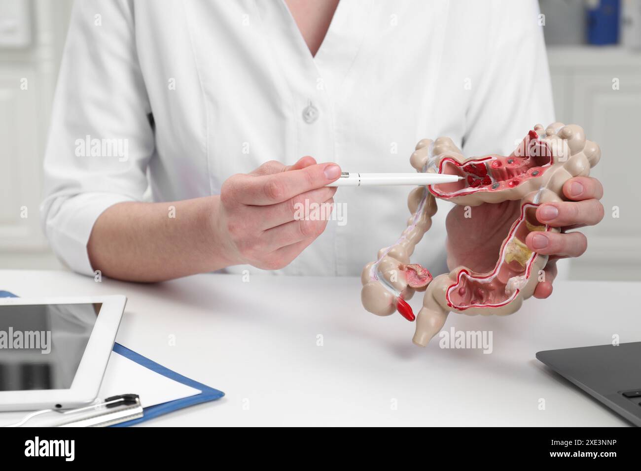 Doctor showing model of large intestine at white table in clinic ...