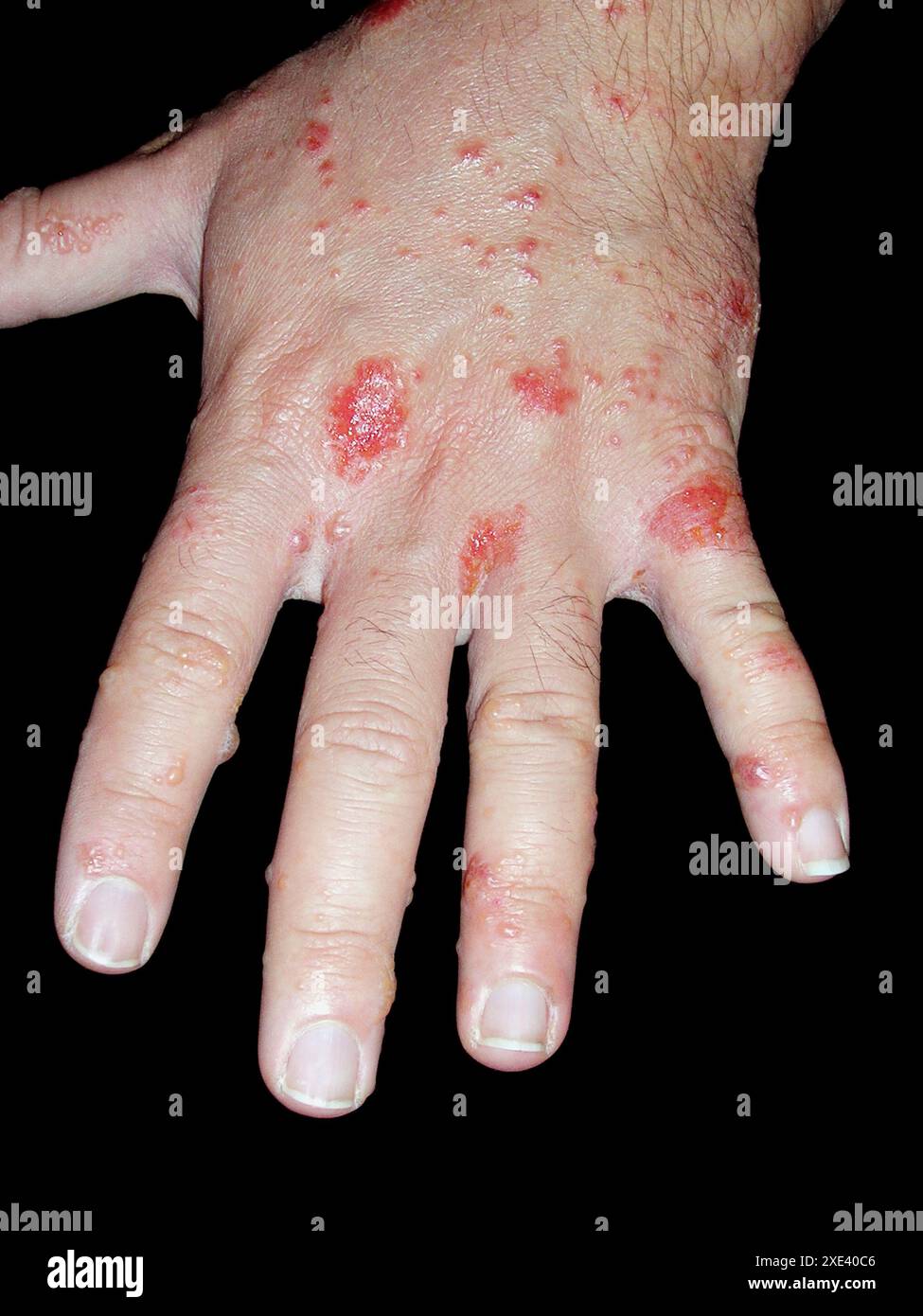 Not to be used for advertising or in a defamatory context Hand of a 27 ...